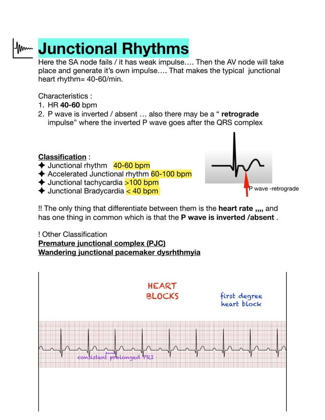 ECG interpret notes.pdf