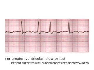 Ecg Interpritation (2) | PPT