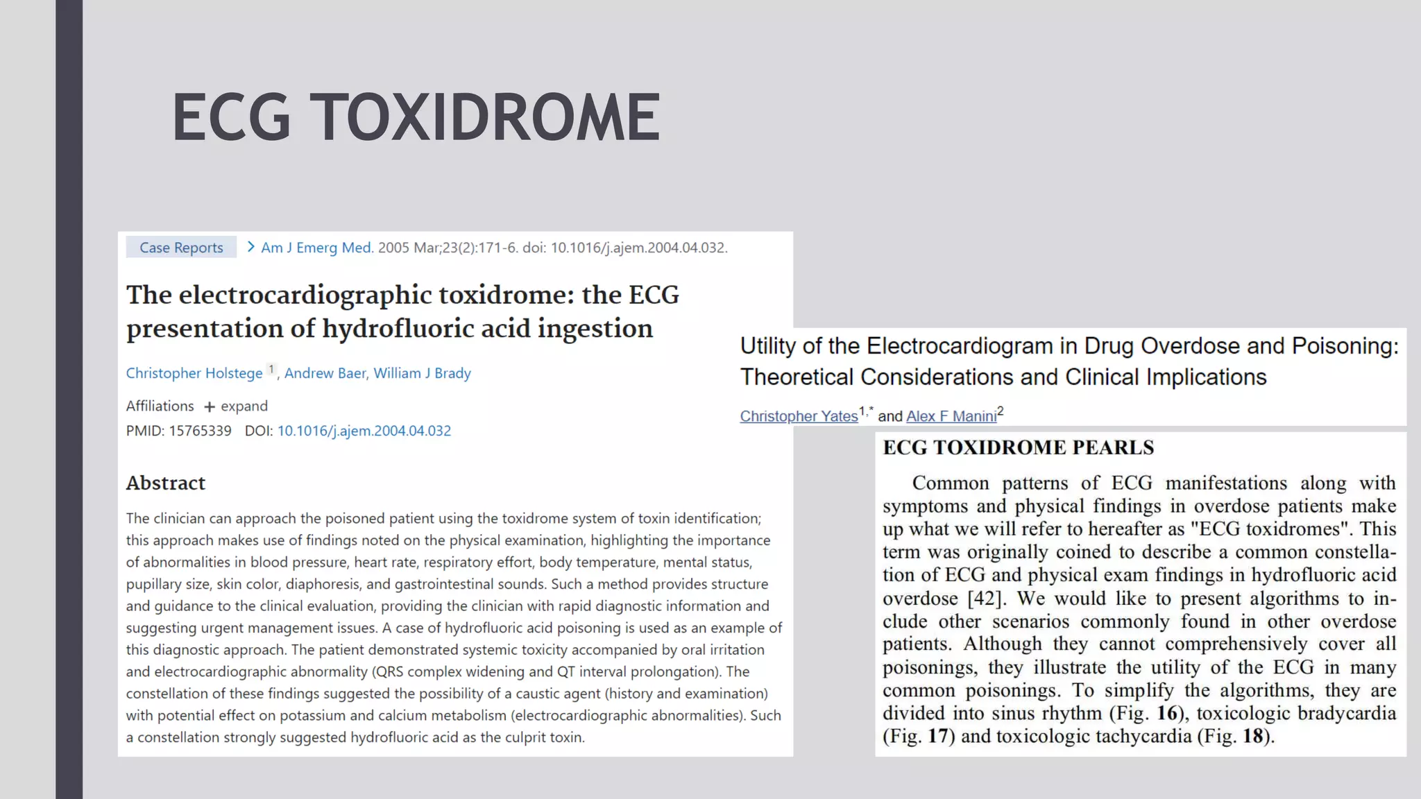 ECG in Toxicology.potx