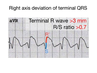 Ecg in Toxicology | PDF | Heart and Cardiovascular Diseases | Diseases ...