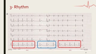 The secret of ECG | PPTX