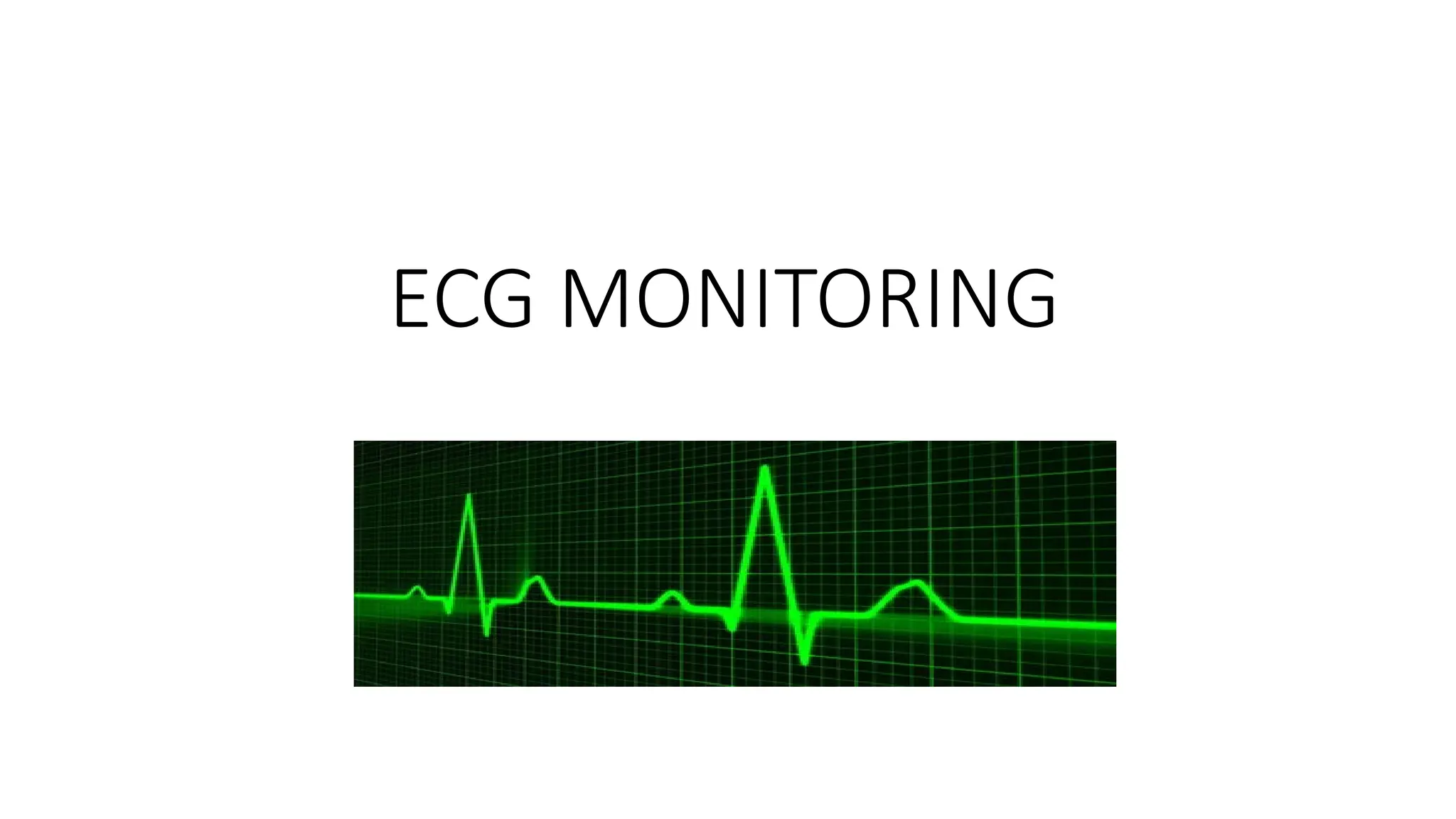 Basics of ECG Interpretation and identifying the abnormal ECG | PPTX