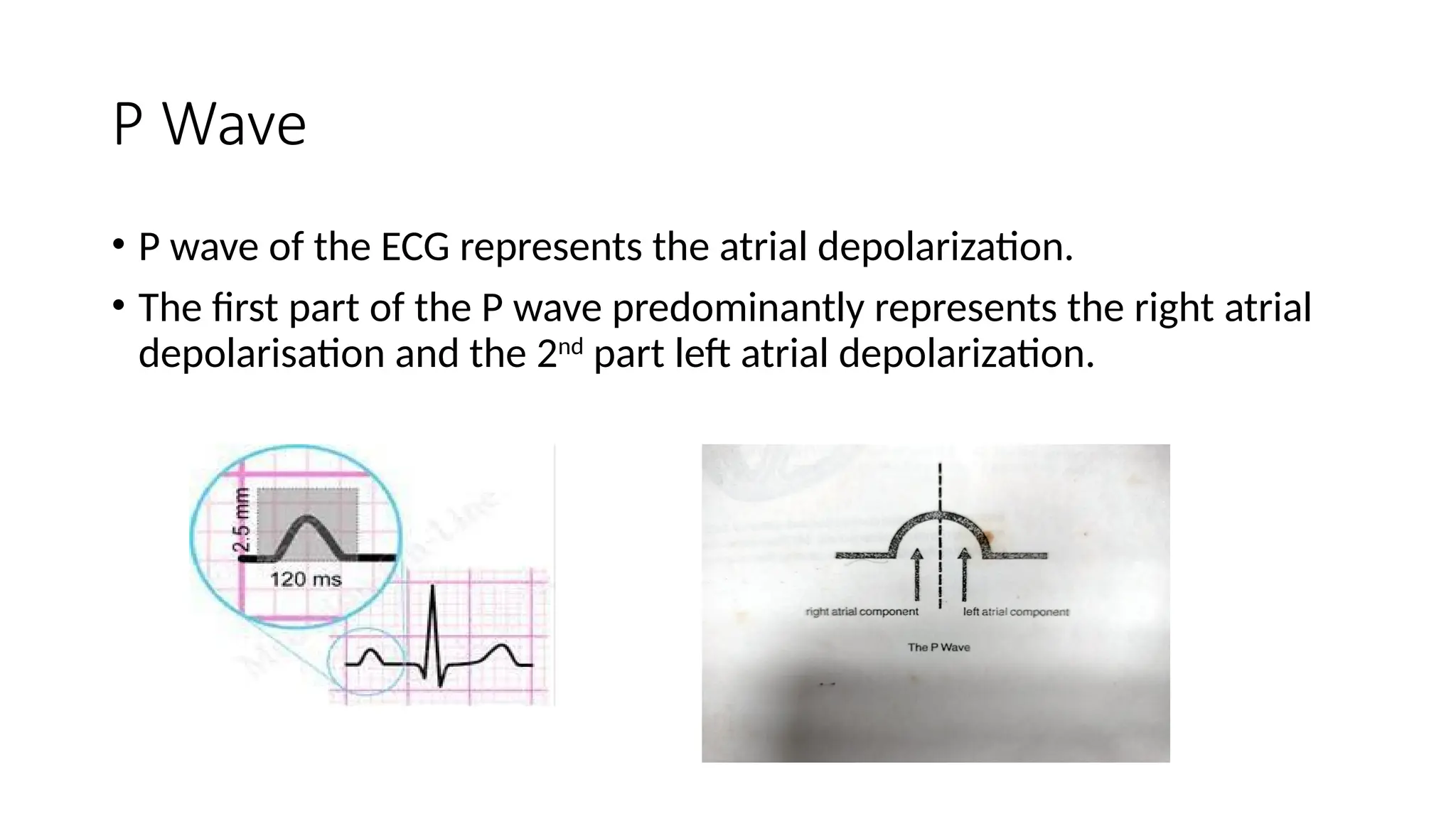 Basics of ECG Interpretation and identifying the abnormal ECG | PPTX