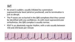 Basics of ECG Interpretation and identifying the abnormal ECG | PPTX