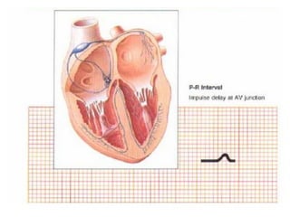 Ecg lead configuration | PDF
