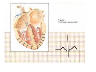 Ecg lead configuration | PDF
