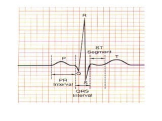 Ecg lead configuration | PDF