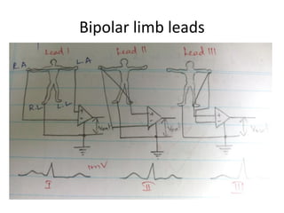 Ecg lead configuration | PDF