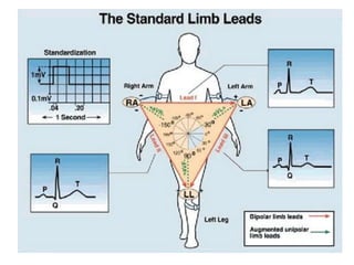 Ecg lead configuration | PDF