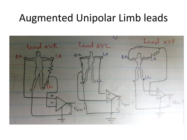 Ecg lead configuration | PDF