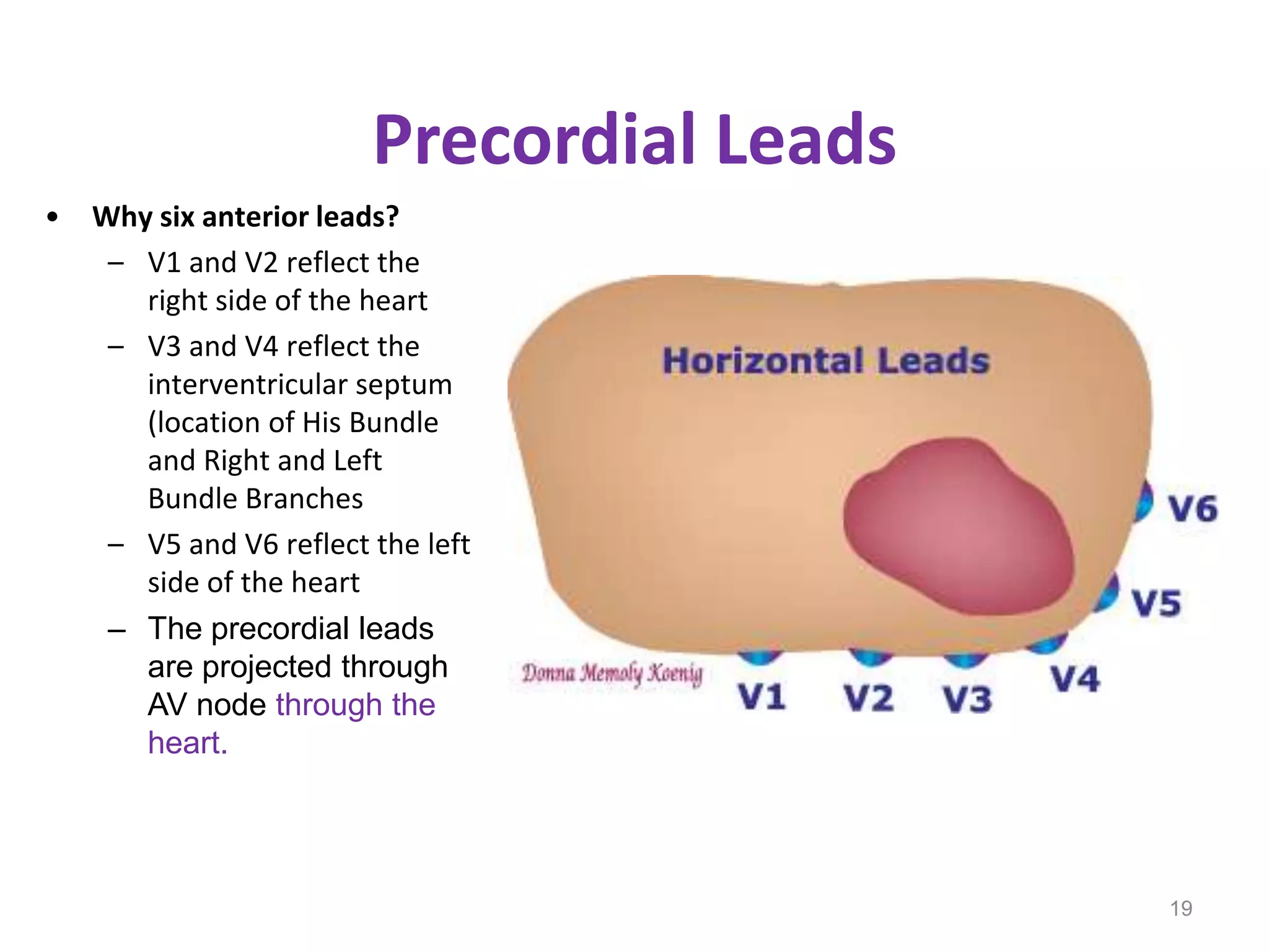 ecgleadsina12-leadecg-121216025516-phpapp02.pdf