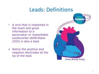 ecgleadsina12-leadecg-121216025516-phpapp02.pdf