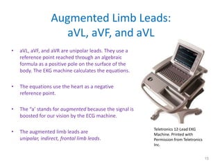 ECG Leads in a 12-Lead ECG | PPT