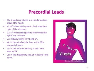 ECG Leads in a 12-Lead ECG | PPTX