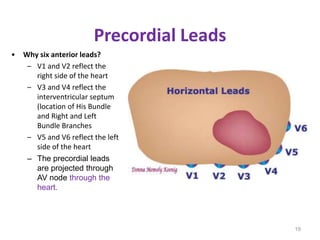 ECG Leads in a 12-Lead ECG | PPTX