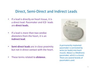 ECG Leads in a 12-Lead ECG | PPTX