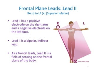 ECG Leads in a 12-Lead ECG | PPTX