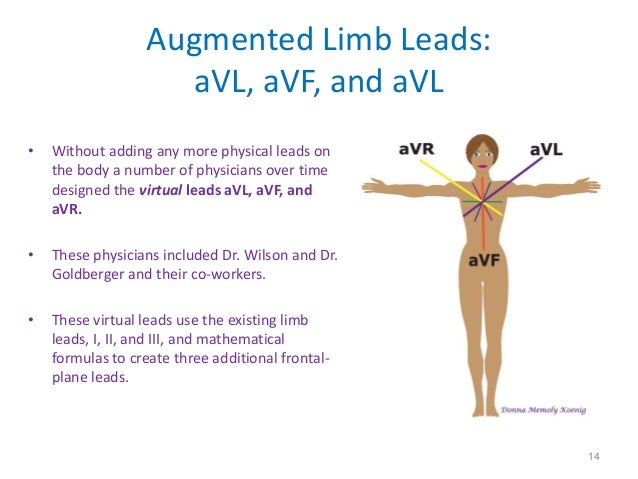 ECG Leads in a 12-Lead ECG