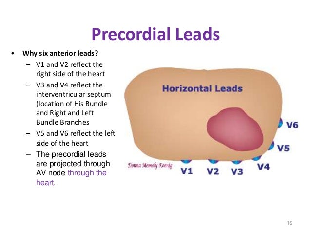 ECG Leads in a 12-Lead ECG