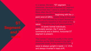 Characteristic of normal ECG | PPTX