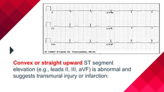 Characteristic of normal ECG | PPTX