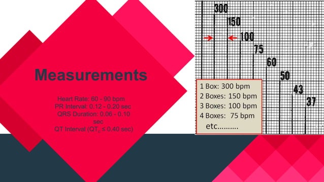Characteristic of normal ECG | PPTX