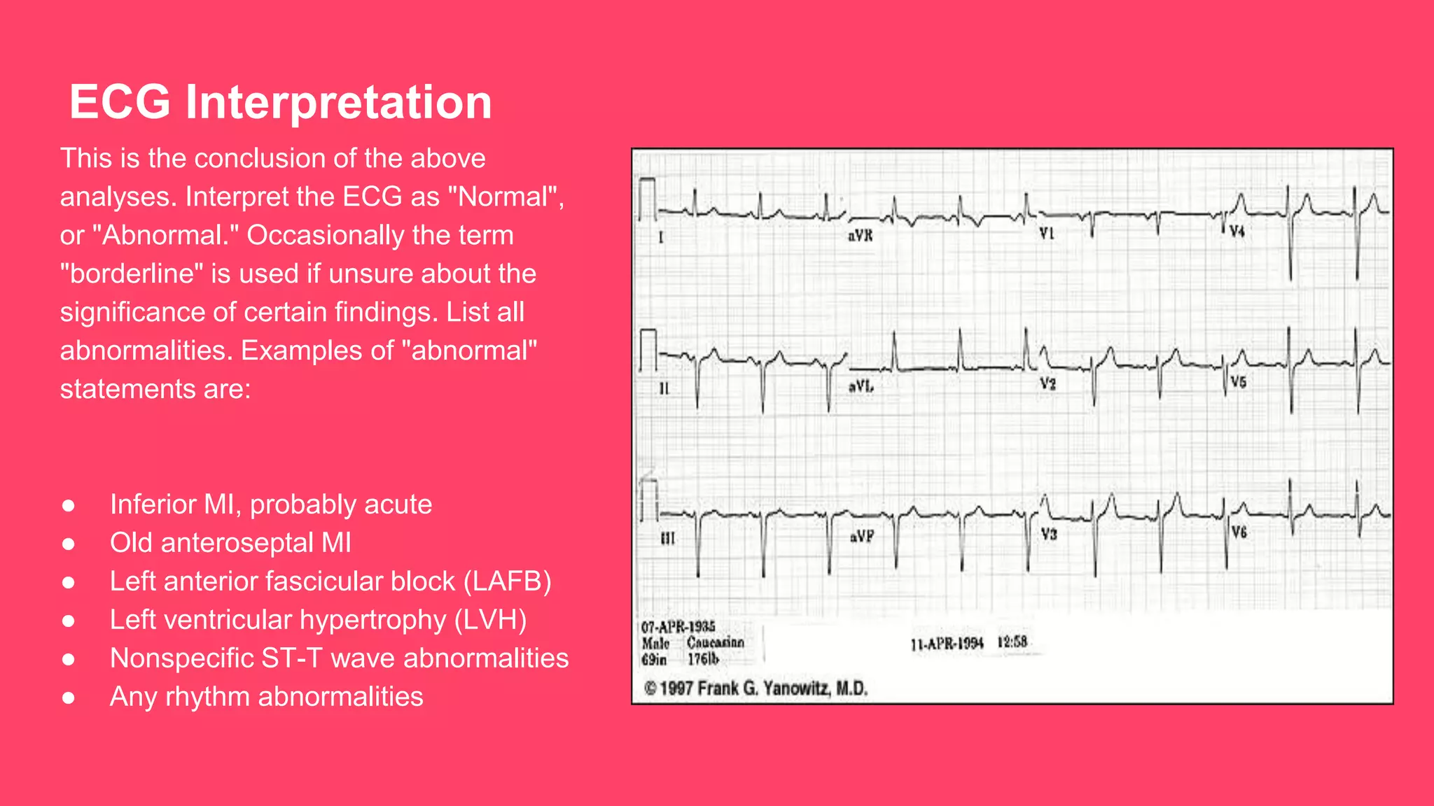 Method of ECG Interpretation | PPTX