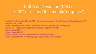 Method of ECG Interpretation | PPTX