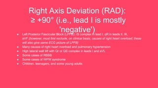 Method of ECG Interpretation | PPTX