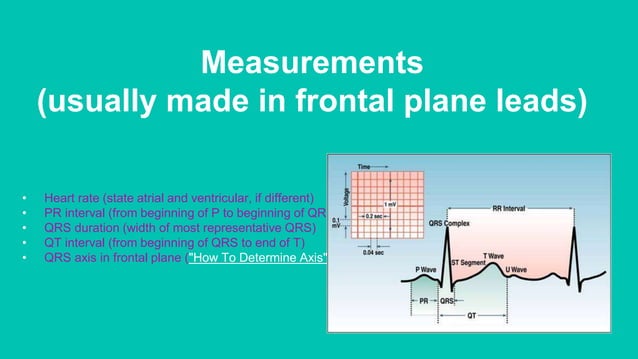 Method of ECG Interpretation | PPT