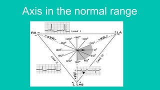 Method of ECG Interpretation | PPTX