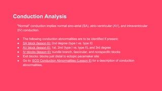 Method of ECG Interpretation | PPTX