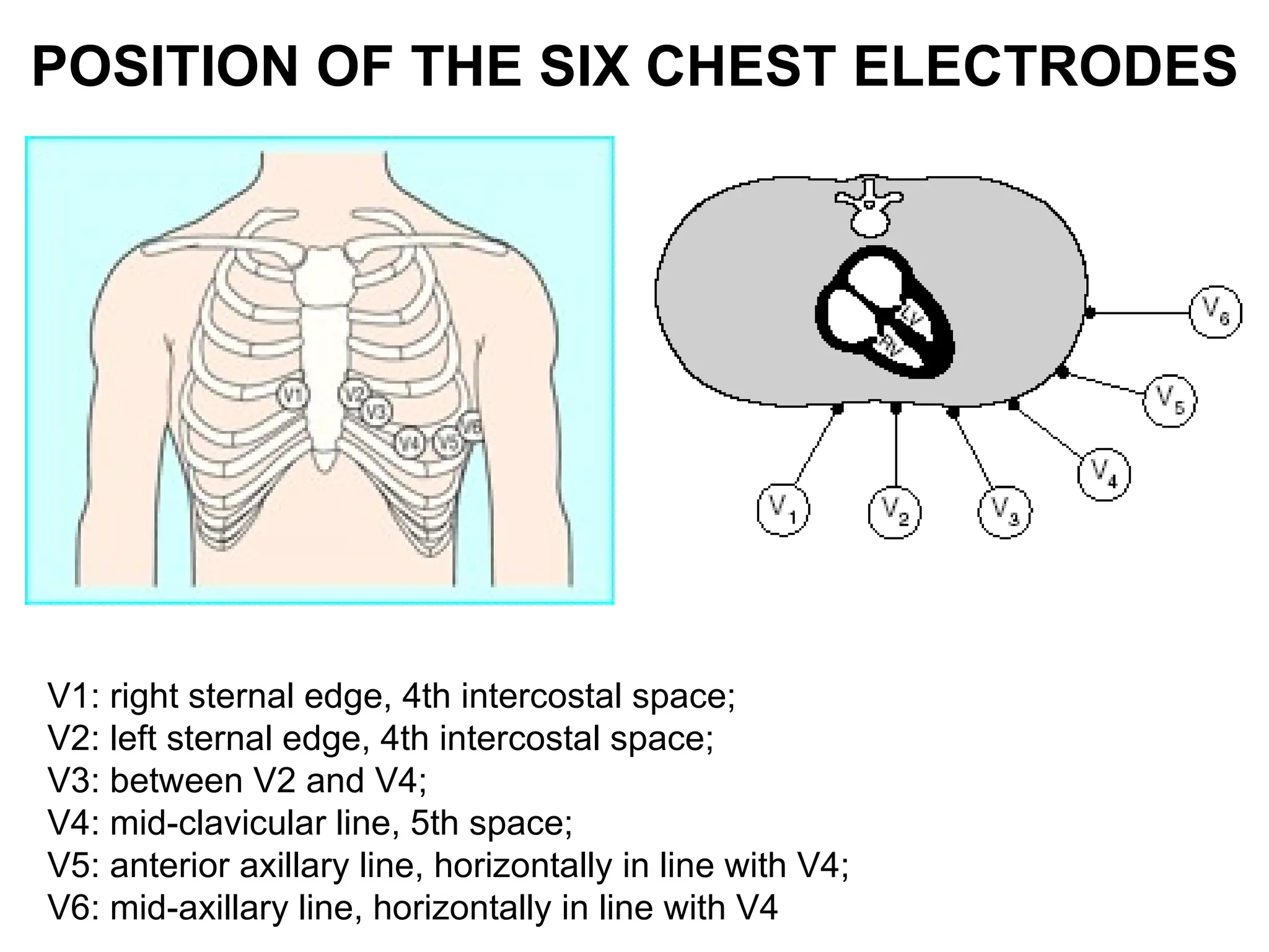 Ecg lecture | PPT