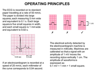 Ecg lecture | PPT