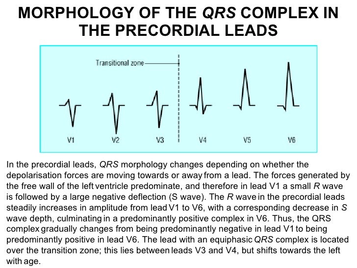 Ecg lecture