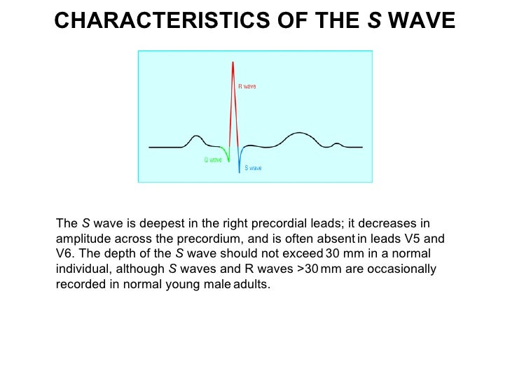 Ecg lecture