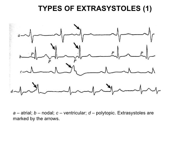 Ecg lecture