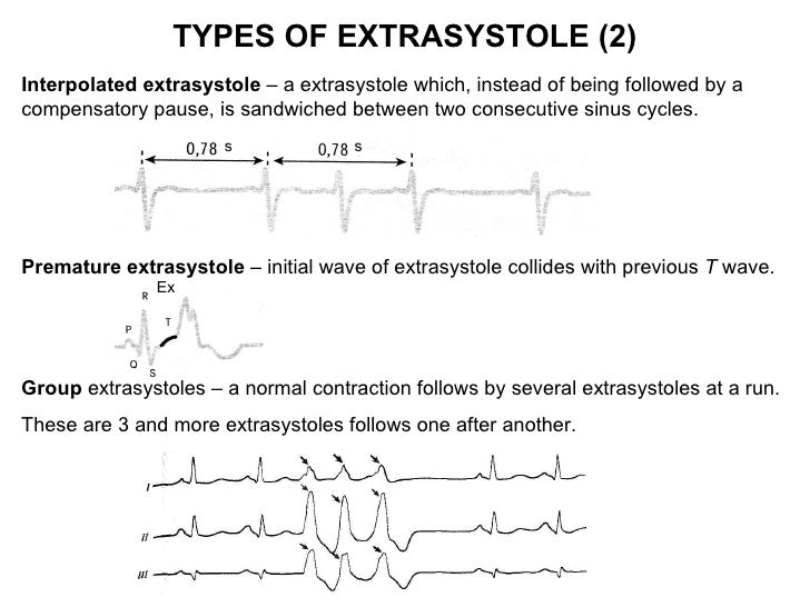 Ecg lecture