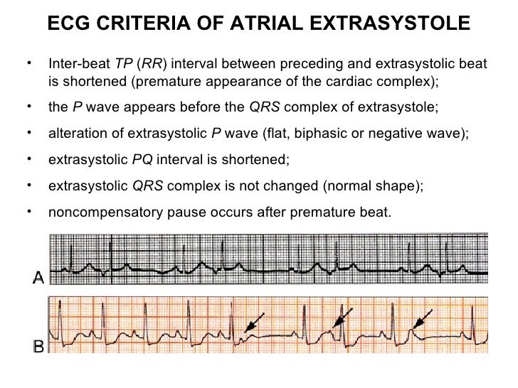 Ecg lecture
