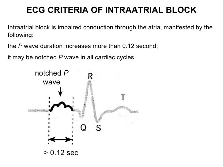 Ecg lecture