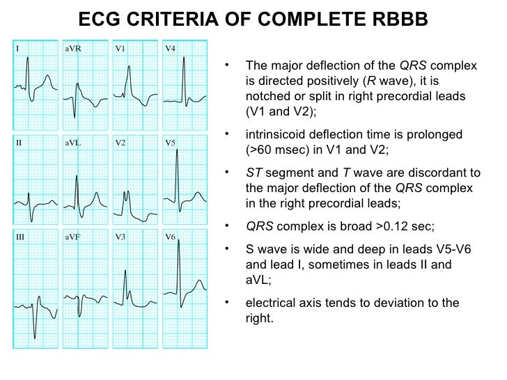 Ecg lecture