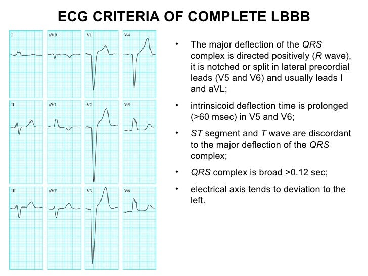 Ecg lecture