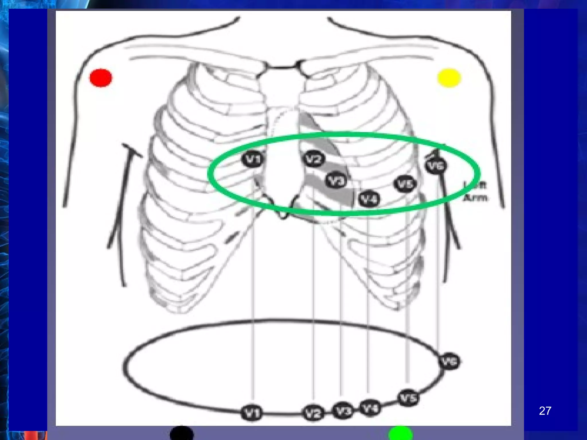 Ecg lecture. nchanji nkeh keneth | PDF