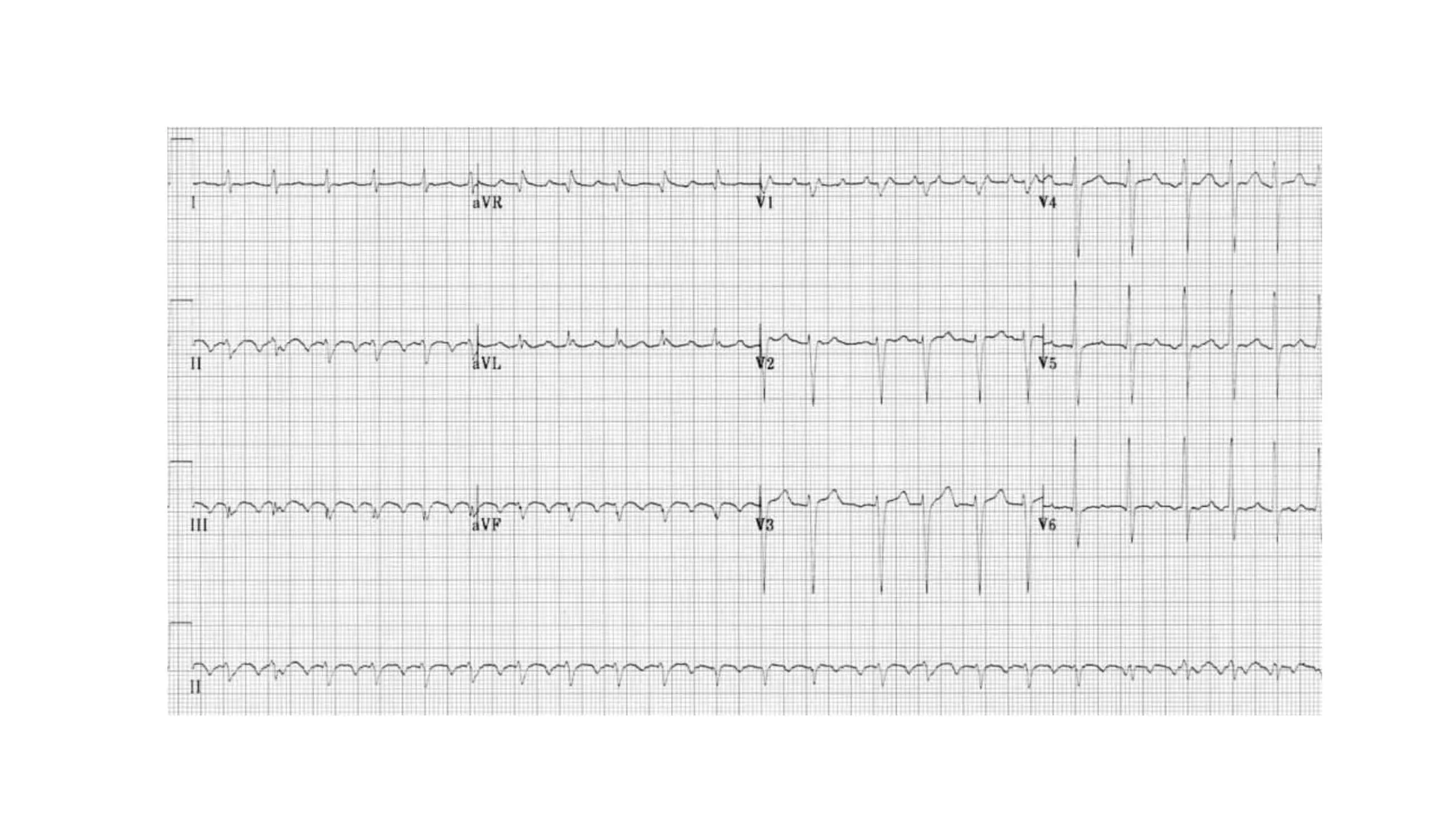 basic in ECG - physiology exam for medical student | PPT