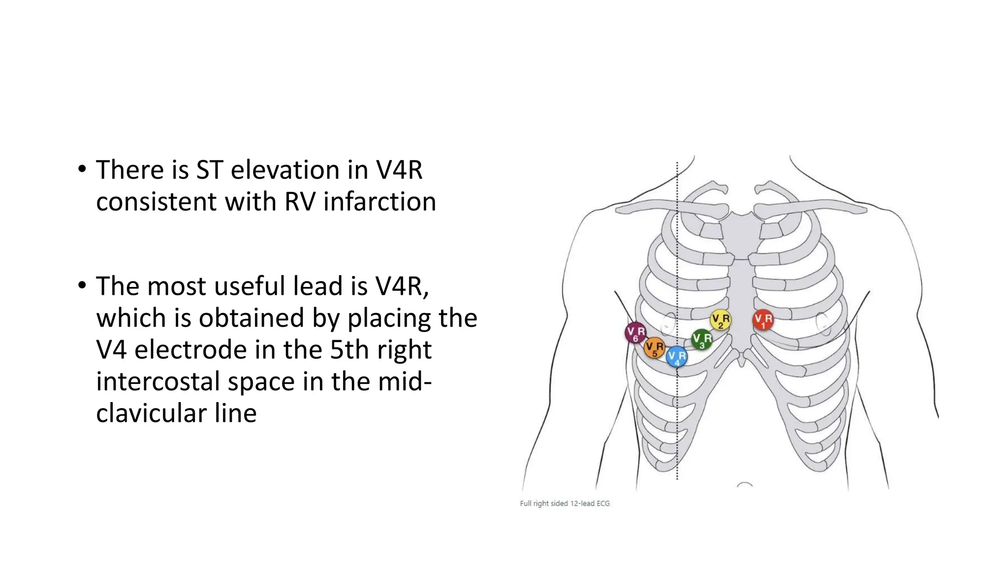 basic in ECG - physiology exam for medical student | PPT