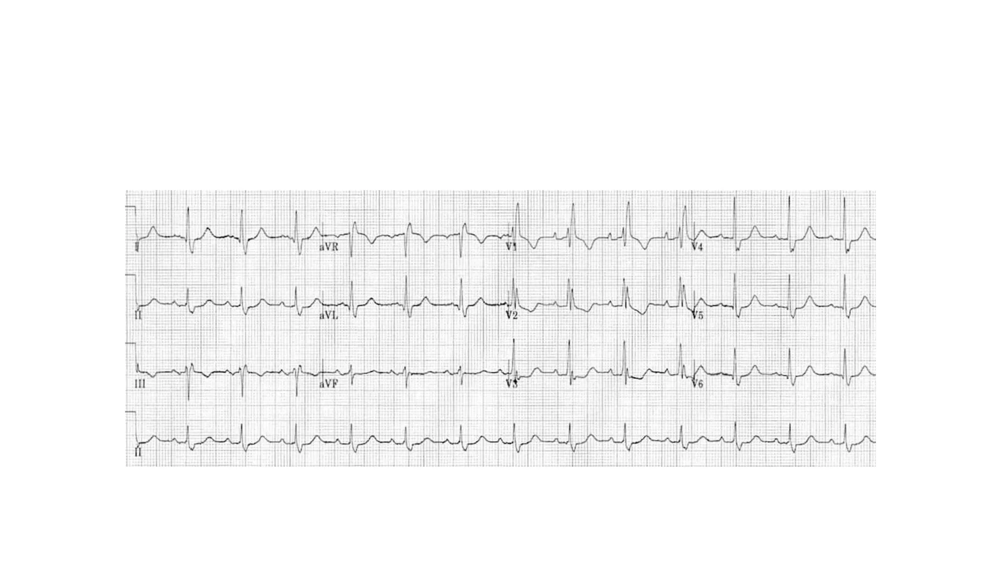 basic in ECG - physiology exam for medical student | PPT