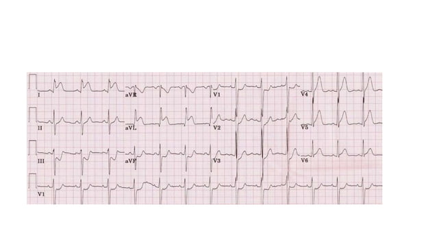 basic in ECG - physiology exam for medical student | PPT