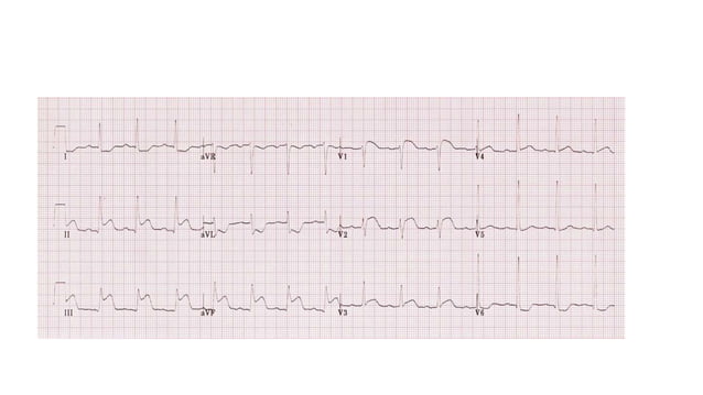 basic in ECG - physiology exam for medical student | PPT