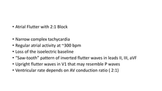 basic in ECG - physiology exam for medical student | PPT