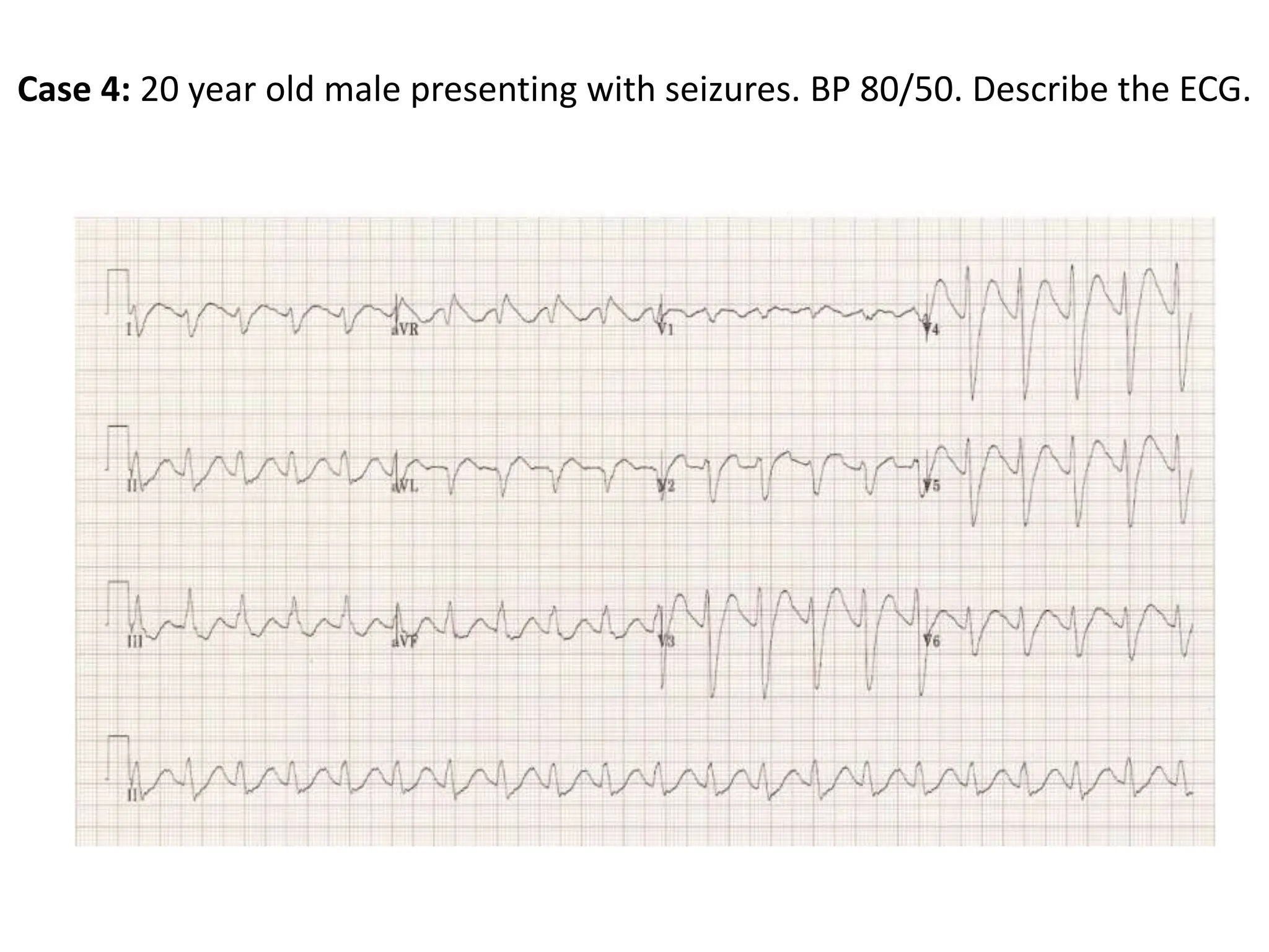 ECG life in the fastlane.pptx